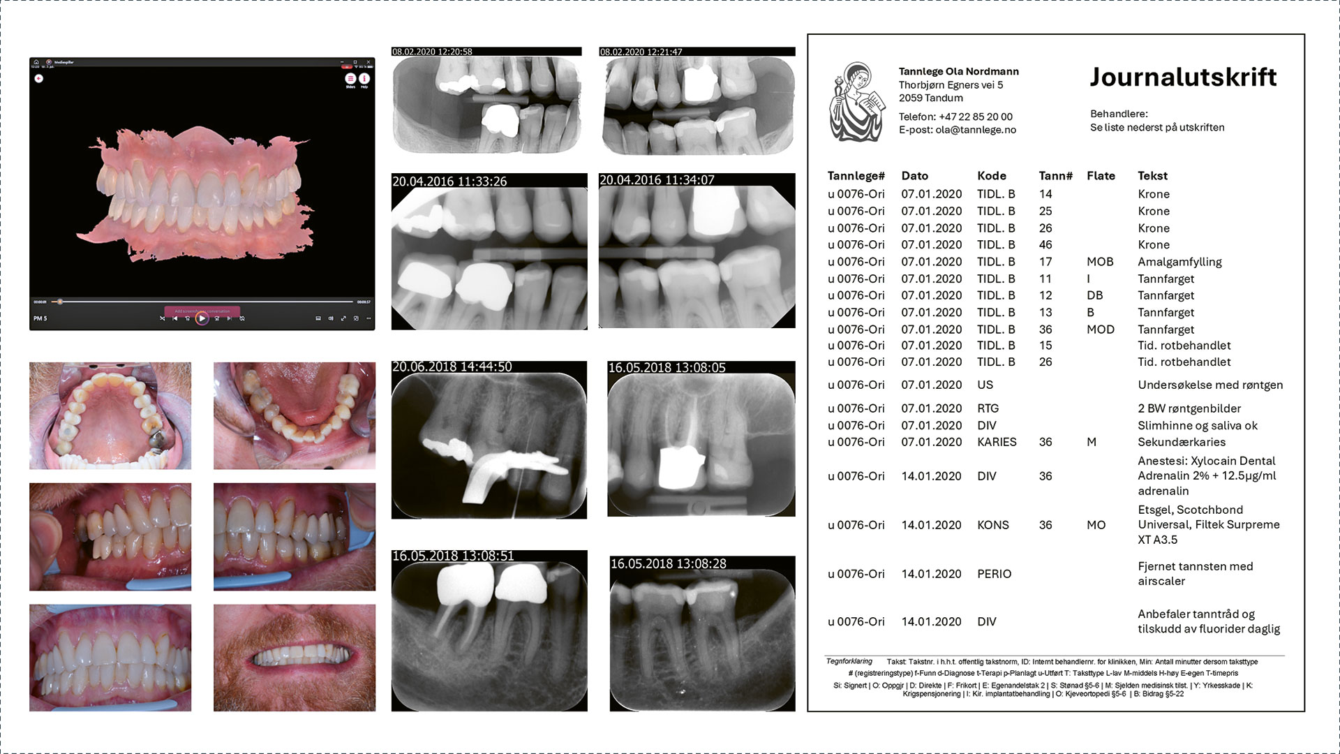 Krav til tannjournaler i de nordiske landene for bruk i ...